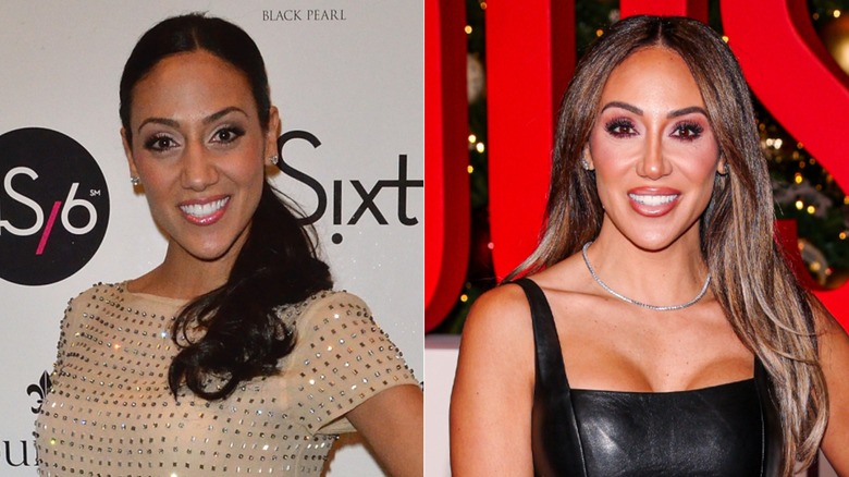 Side By-Side Pics Show How Plastic Surgery Transformed These Bravo Real ...