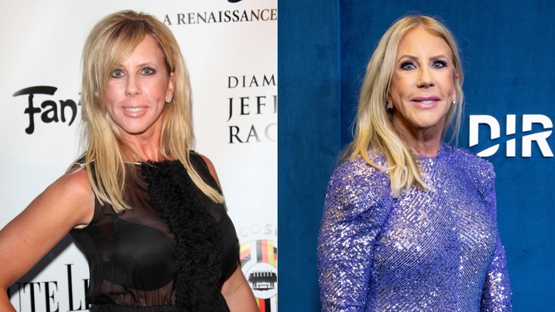 Side By-Side Pics Show How Plastic Surgery Transformed These Bravo Real ...